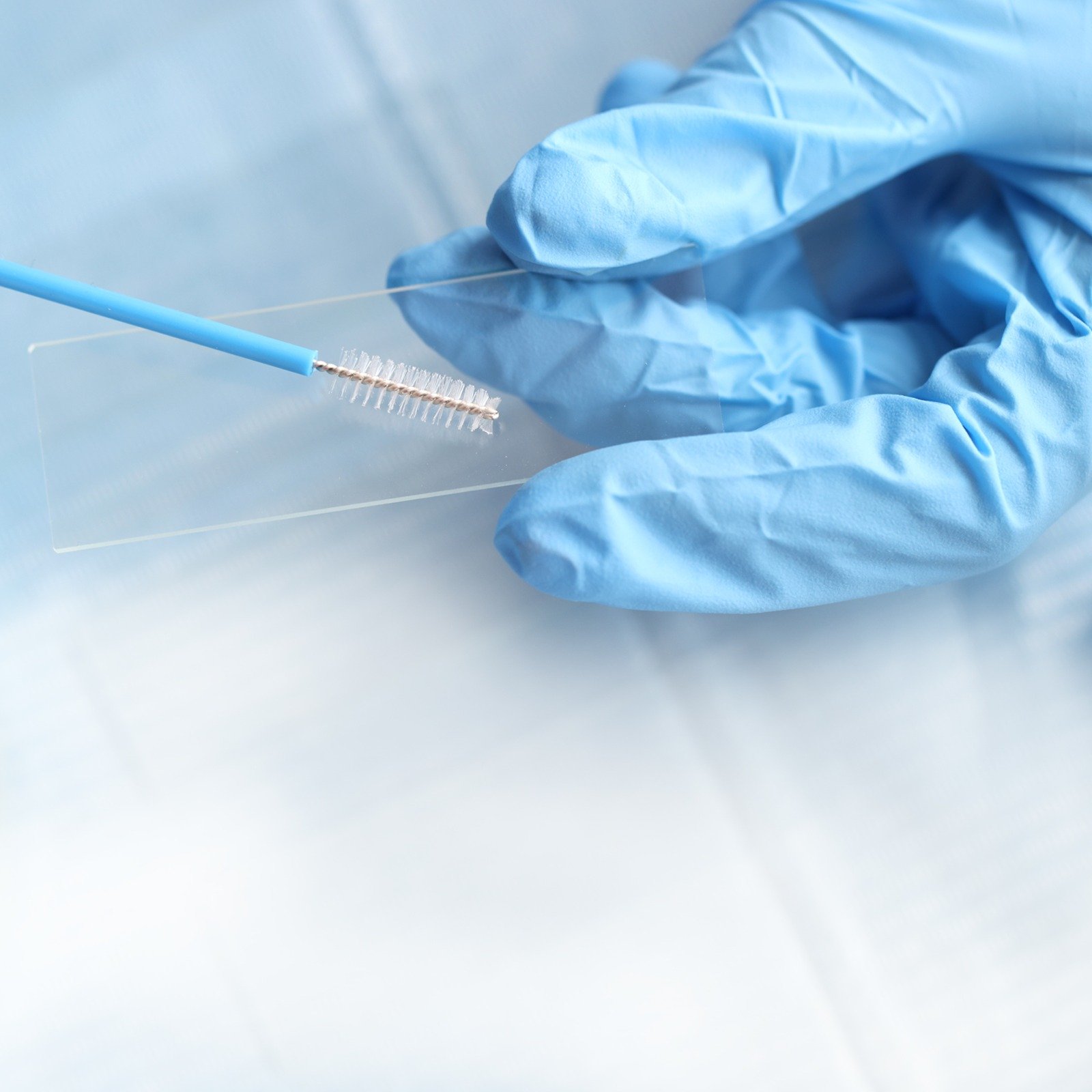 Smear Test | Özel İstanbul Hospital